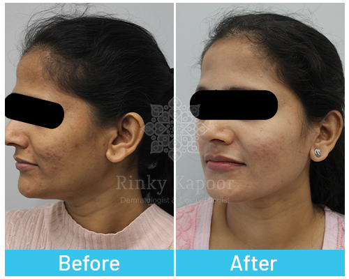 Esthetic Face Brite™ | Advanced Skin Brightening Treatment